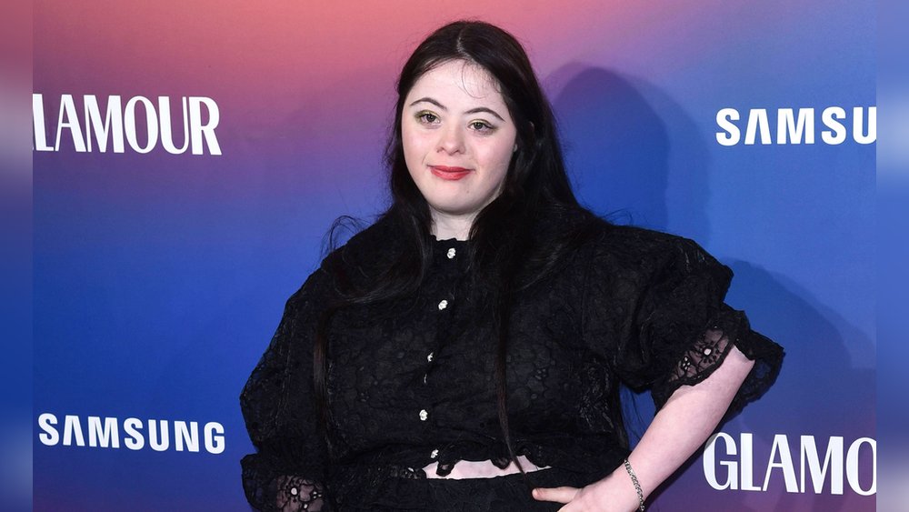 Ellie Goldstein: "Vogue"-Model erobert das Tanzparkett