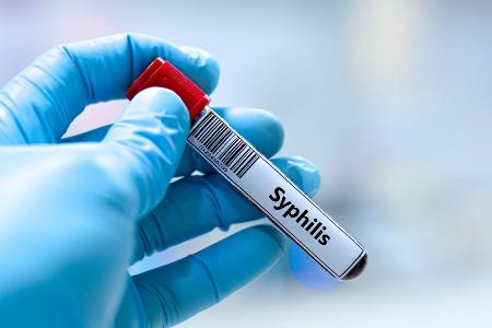 Tripper und Syphilis: Geschlechtskrankheiten breiten sich in Europa aus